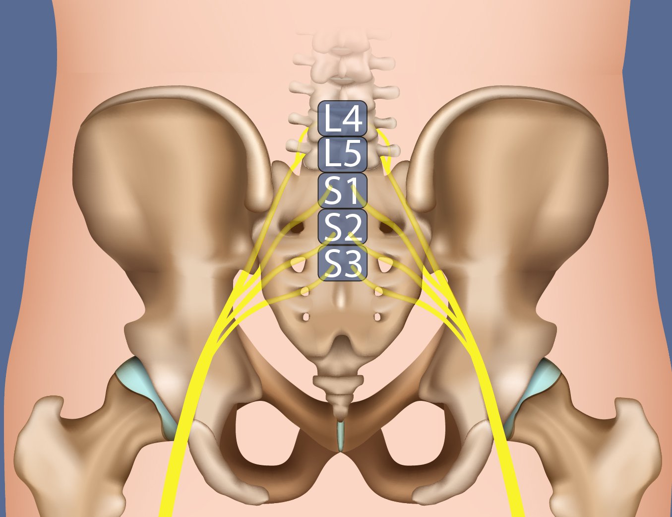 Sciatica Symptoms Diagnosis Treatment Miami Neuroscience Center