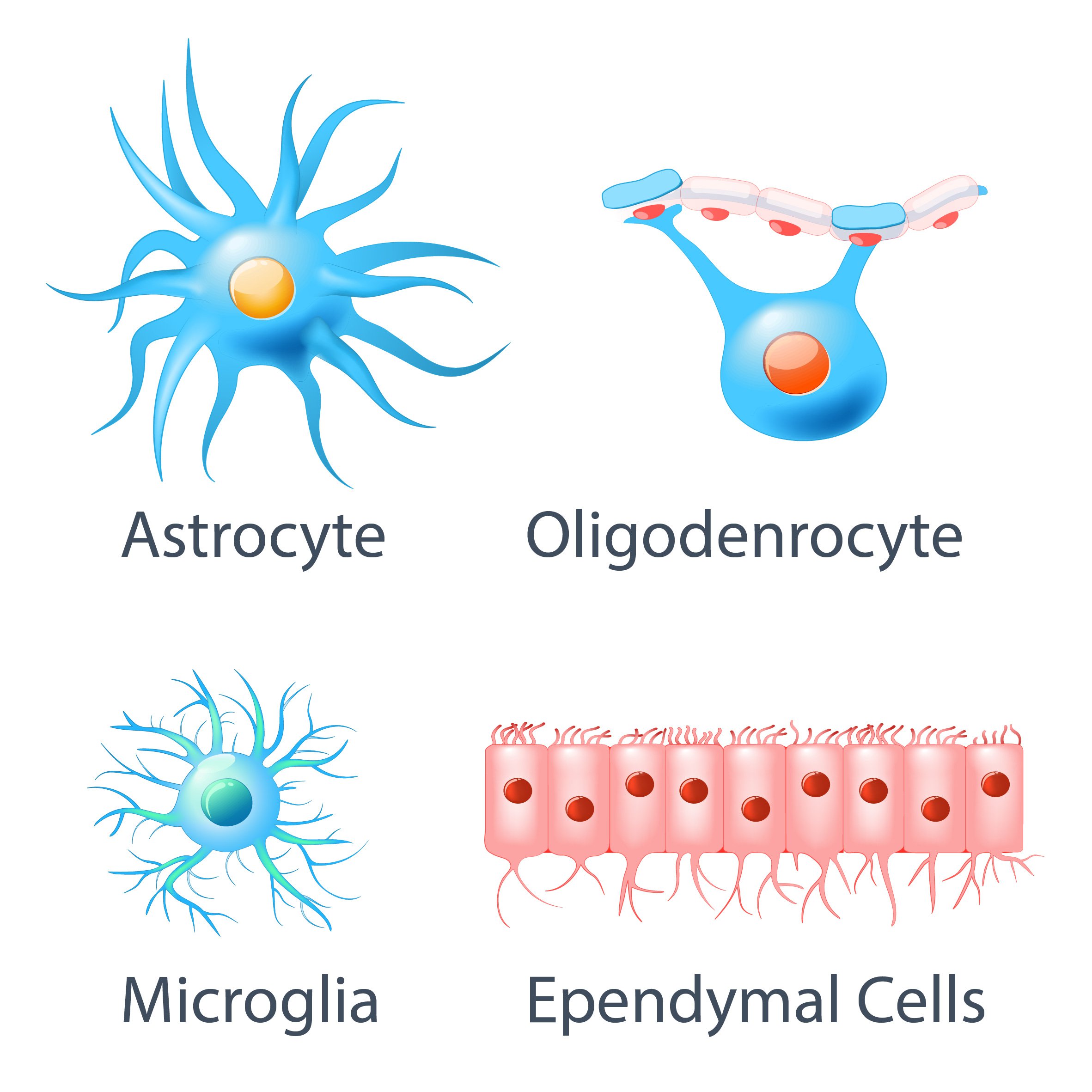 Brain Tumor Types Glioblastoma Meningioma More